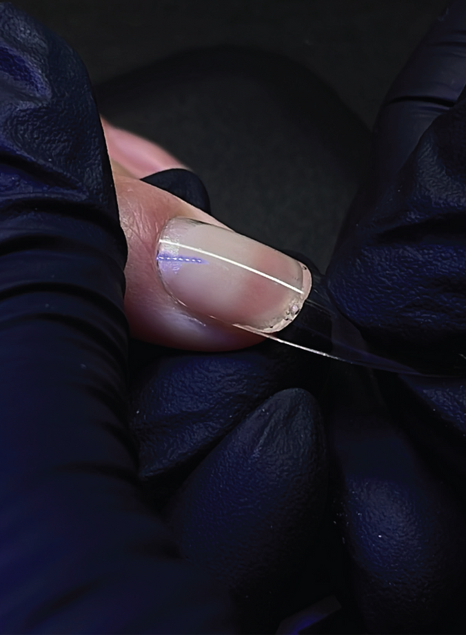 SOFTIPS PRO™ – SOFGEL